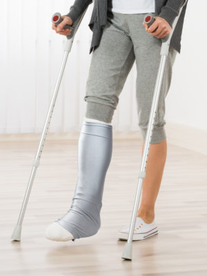 LimbO Leg Cast Sleeve - LimbO Products | Thesis Technology